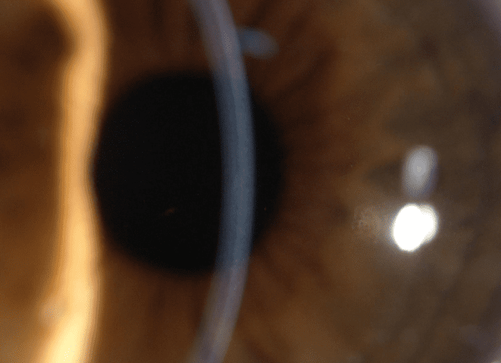 Imagen Oftalmologica